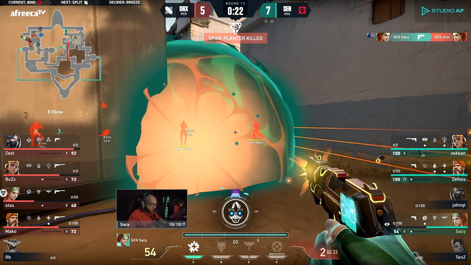 Is Sentinels TenZ the best Omen in Valorant now? He beat #1 | ONE Esports